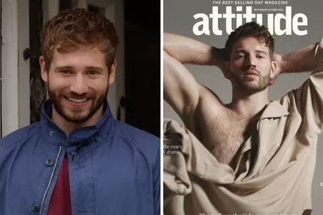 Emmerdale’s Alexander Lincoln says his romances ‘burn out’ as he ...